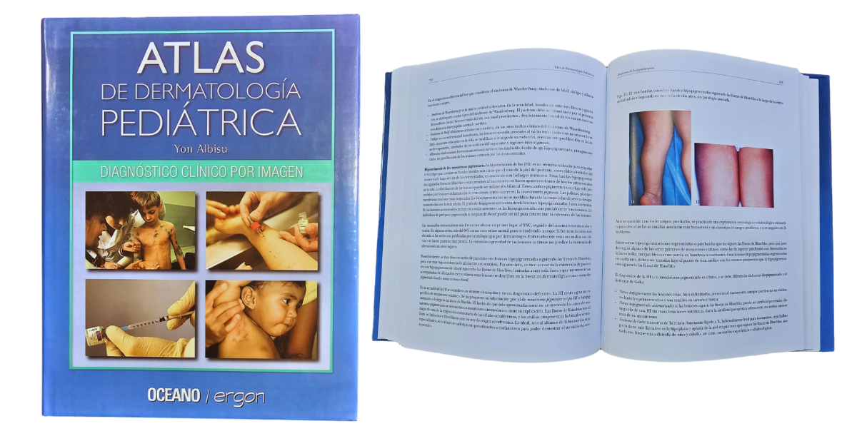 ATLAS DE DERMATOLOGIA PEDIATRICA 1 TOMO - Programa Educativo Nacional ...